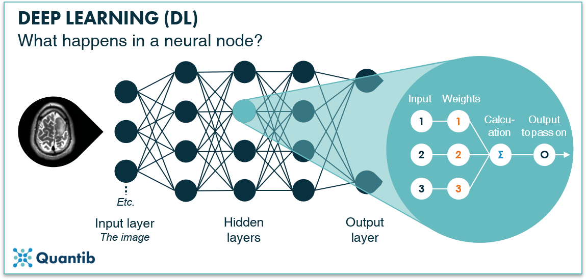 How does deep learning in radiology work? How does deep learning in radiology work?